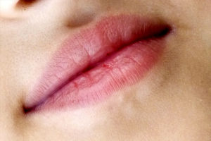 What Your Lip Colour Say About Your Health | Hergamut.in